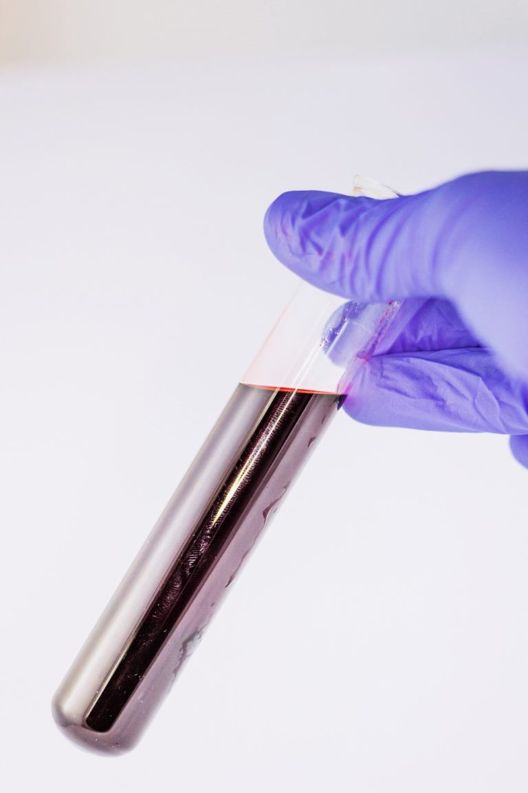 Blood culture contamination–it’s a big deal - Division of Infectious ...